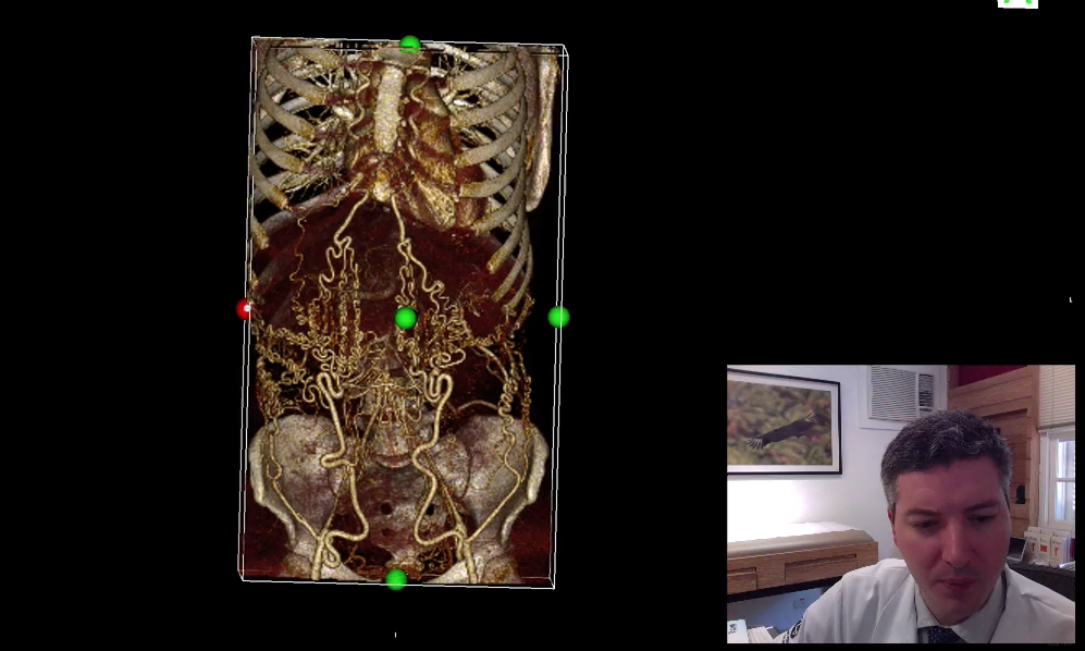 3D Volume Rendering - básico | Curso OsiriX